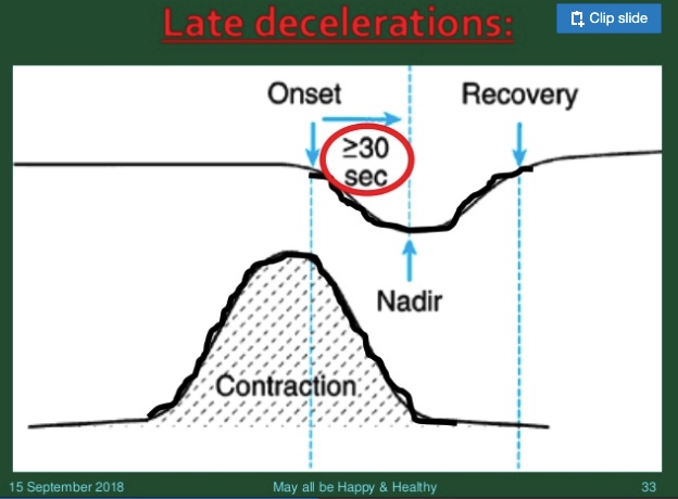 Med4yu: CTG scenarios