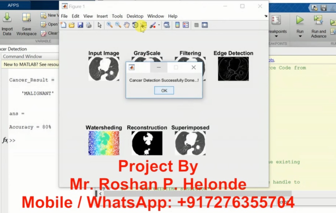 Lung Cancer Detection using Image Processing Matlab Source Code ... Lung Cancer Detection using Image Processing Matlab Source Code ...