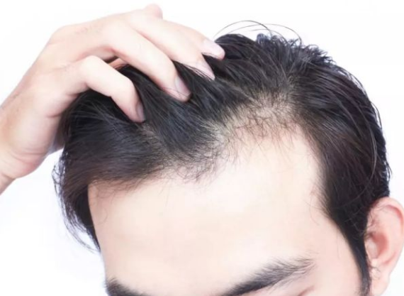 What is the difference between hair loss and normal hair loss? - Beauty
