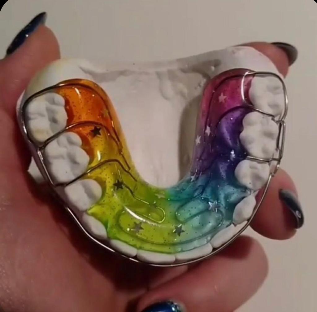 Diamond Dental: Placa Hawley en Ortodoncia