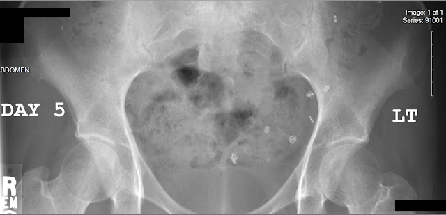 Blogged Up Body - Blogged Up Life : Radiology