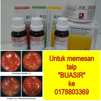 PRODUK KESIHATAN DALAMAN & LUARAN: Set Buasir Pelbagai Peringkat