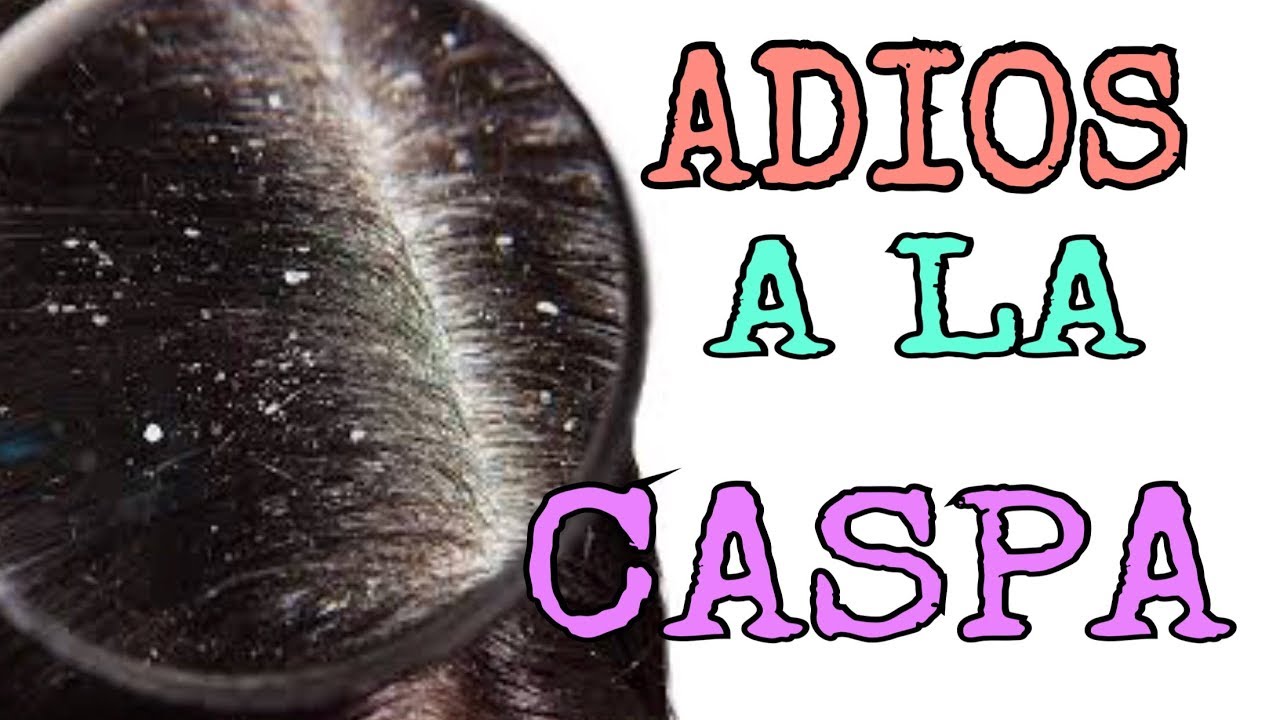 El Remedio mas Eficaz: Remedios caseros para eliminar la caspa.