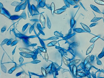 Fun With Microbiology (What's Buggin' You?): Microsporum canis