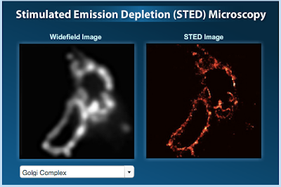 Wise Silence: Stimulated Emission Depletion (STED) Microscopy