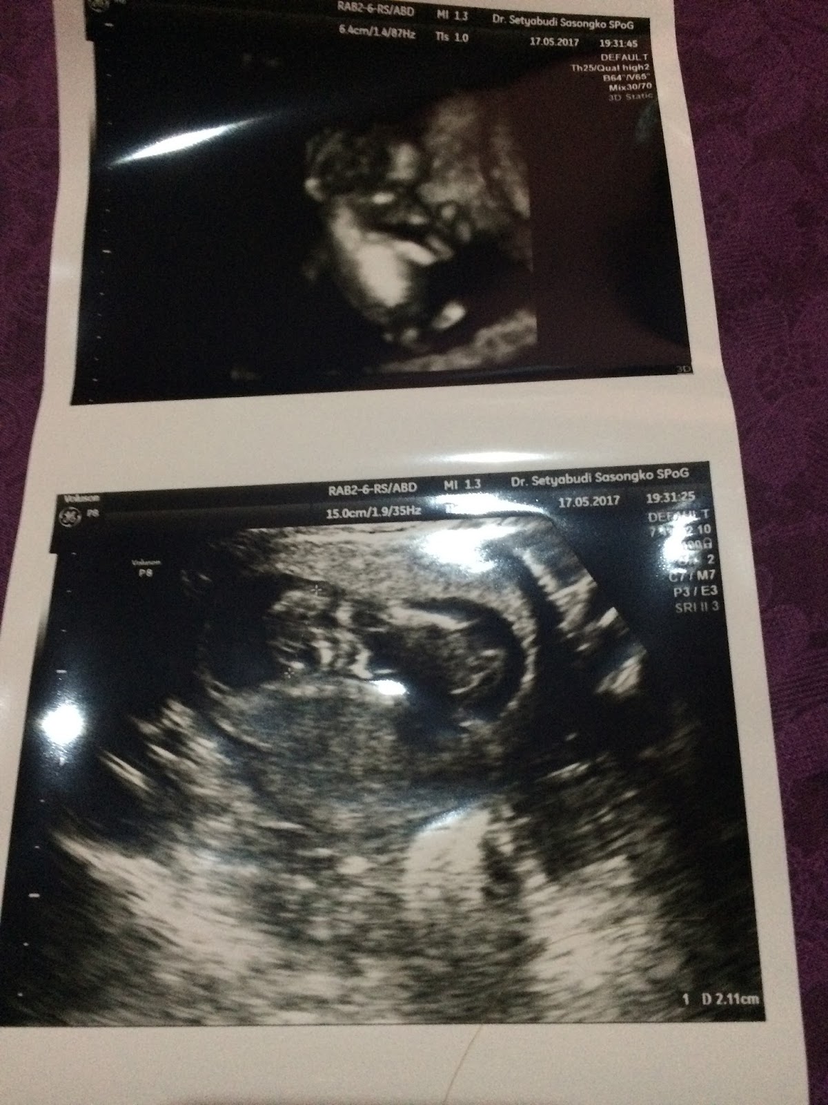 Perjalanan panjang penantianku demi engkau buah hatiku: Promil Dr.Med ...