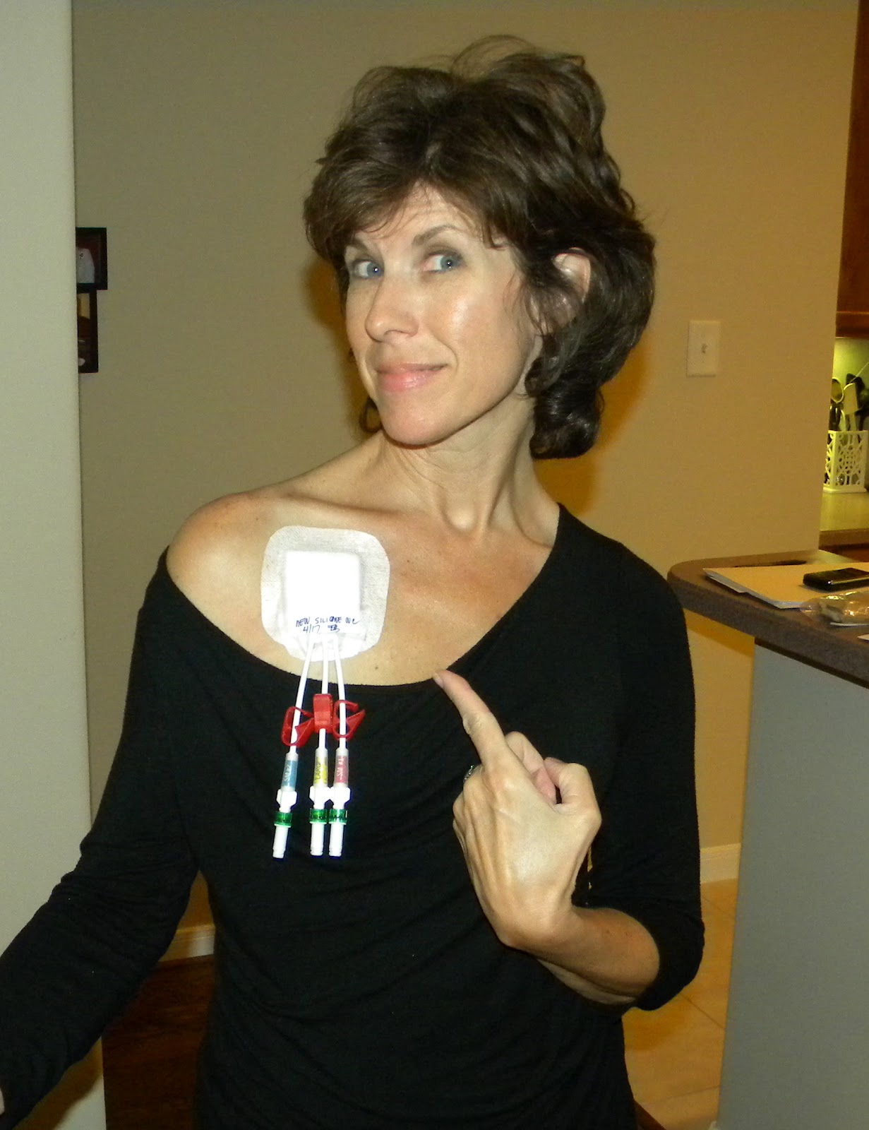 Our Journey...: Central Venous Catheter (CVC)