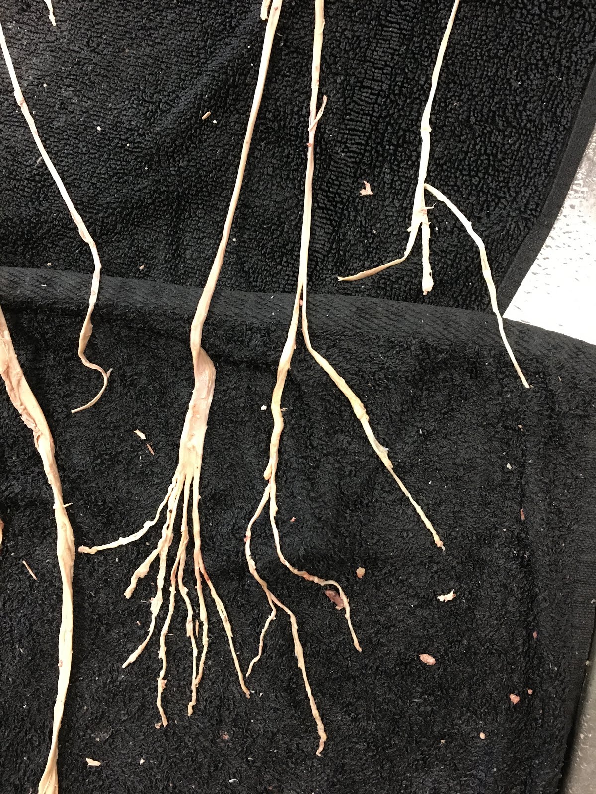 neuropathology blog: Remarkable en bloc dissection of human central and ...