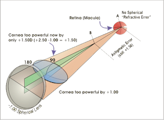 The Astigmatic Eye | Refraction in Astigmatism