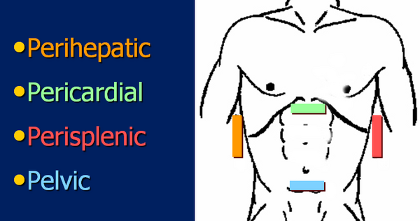 Sonographers Blog: Fast Scan Gets a Boost With New Software