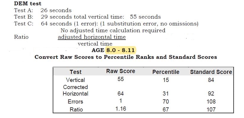 進達眼鏡-視光新知分享: Developmental Eye Movement Test (DEM) DEM測試