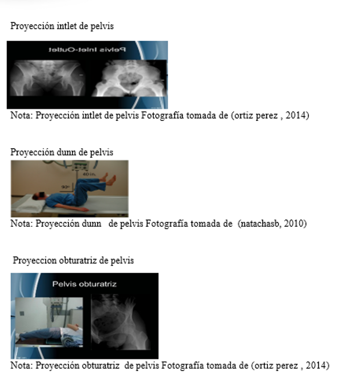 CREACION DE PROTOCOLOS : ESTUDIOS RADIOGRAFICOS DE CADERA Y PELVIS