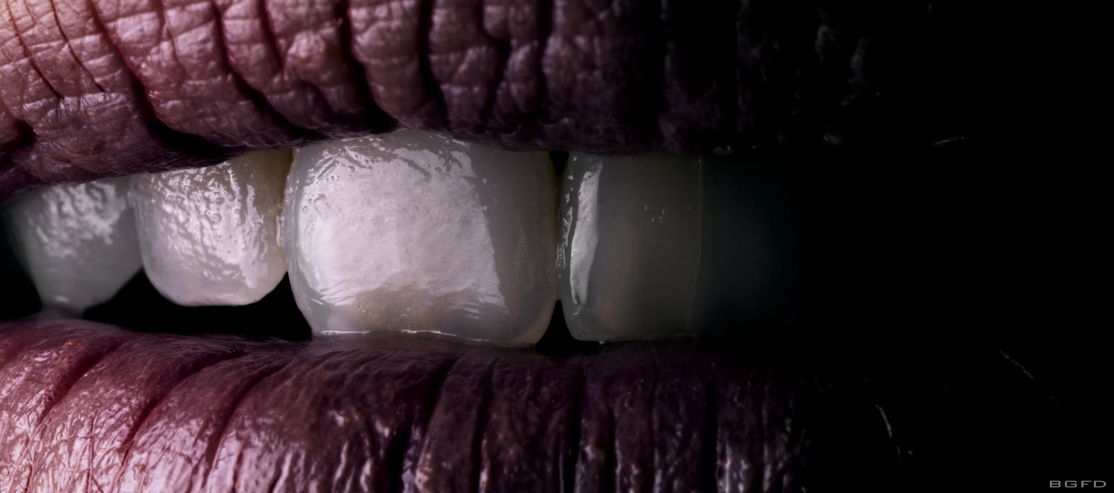 - BG Fotografía Dental