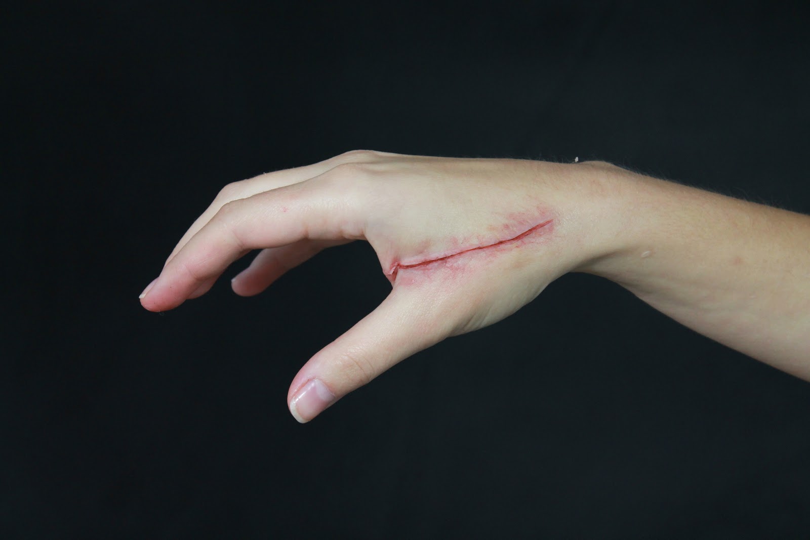 Valertine Myland: Rany, rany, rany...