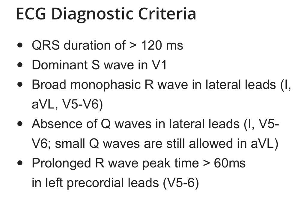 LBBB (IN ECG) CRITERIA