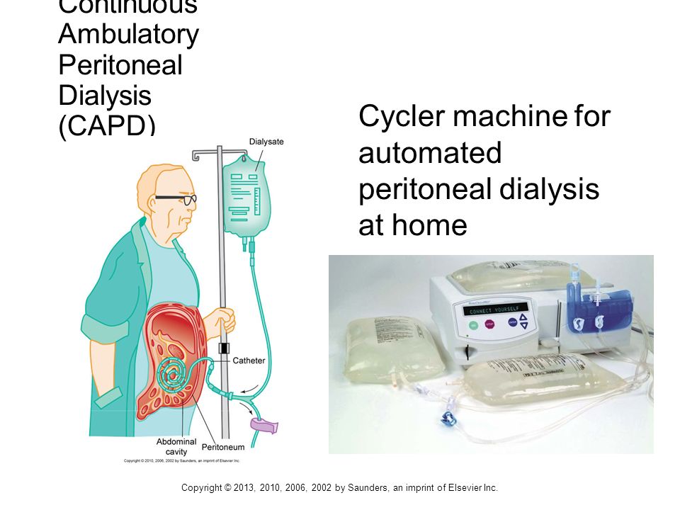 Rawatan untuk pesakit buah pinggang (bhg. 3)