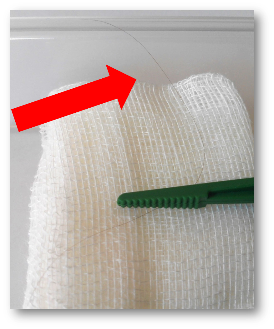 Segurança do Doente: Relato Incidente – Kit de Penso Descartável ...