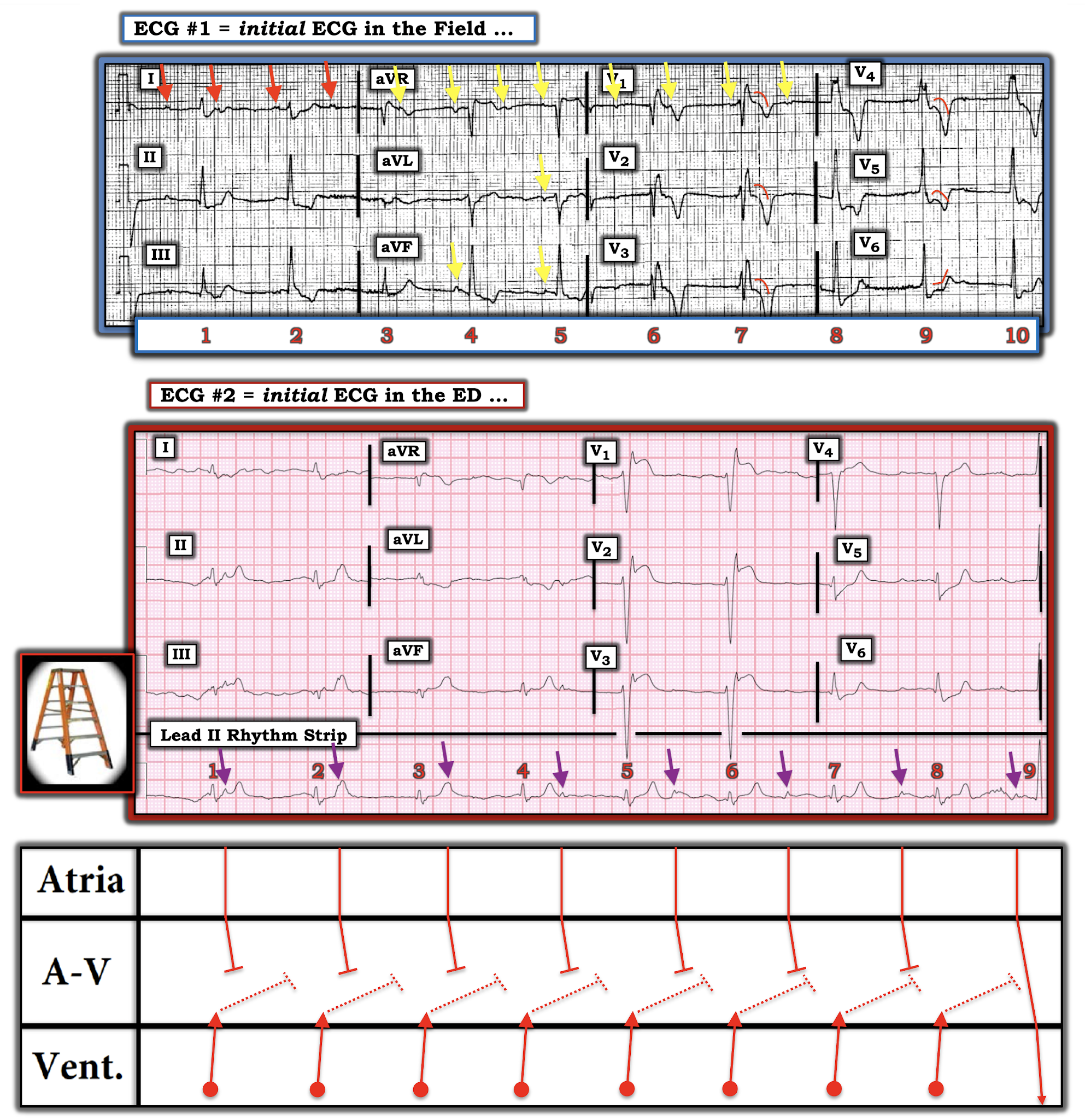 Dr. Smith's ECG Blog: September 2020