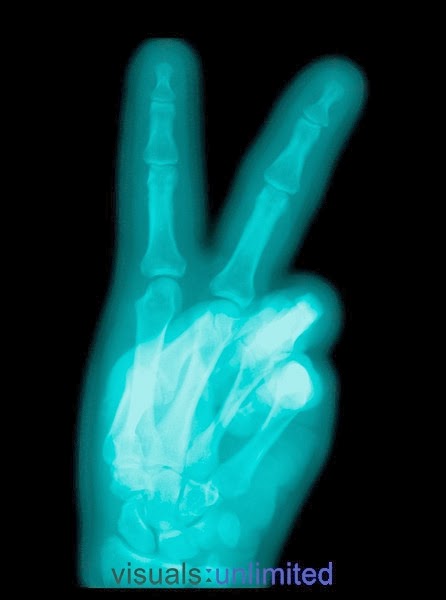 The Premature Curmudgeon: The Blog Turns Two. Now What?