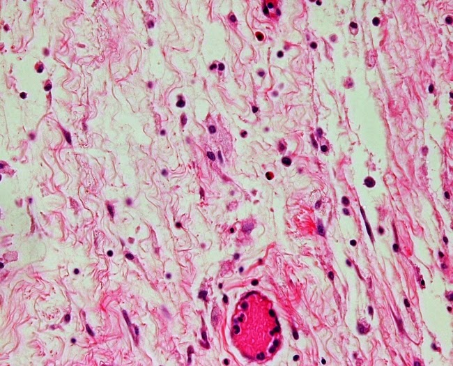 Andrea: TEIXITS CONNECTIUS