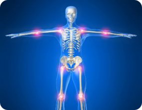 MEDICINA: TUDO SOBRE REUMATISMO