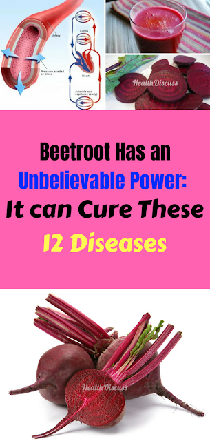 Health Discuss: Beetroot Has an Unbelievable Power: It can Cure These ...