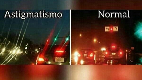 El astigmatismo