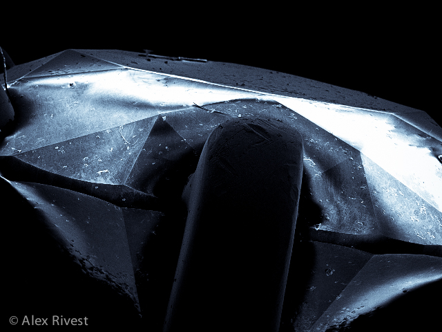 AJRpic of the Week.: Week 1 May 2013: Electron Microscope Image of a ...