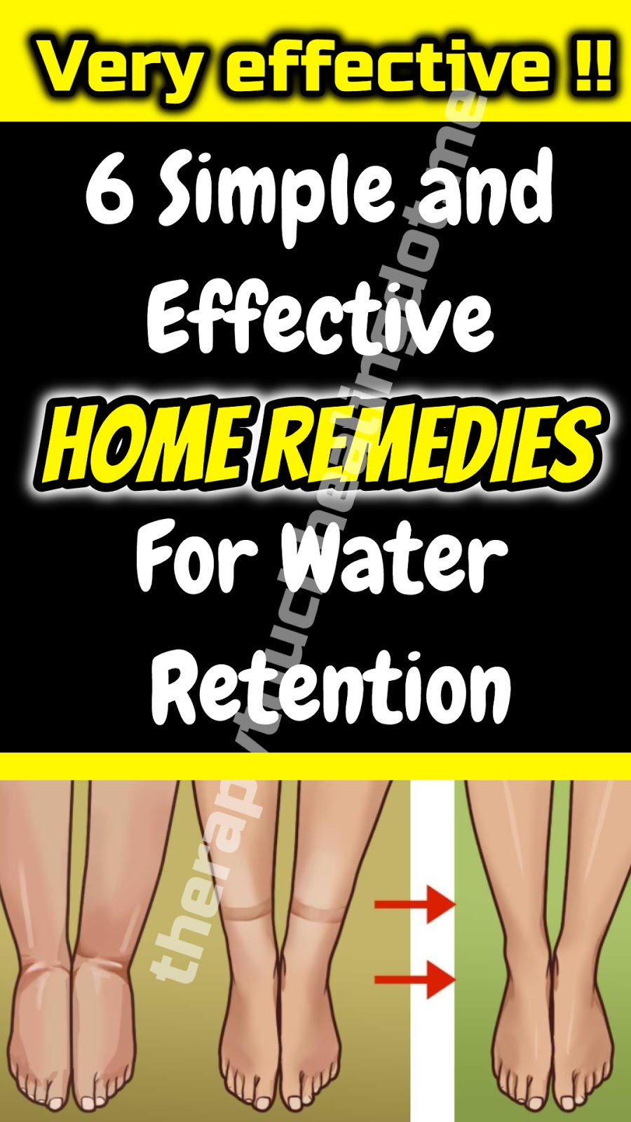 6 Simple and Effective Home Remedies For Water Retention - Nutrition ...