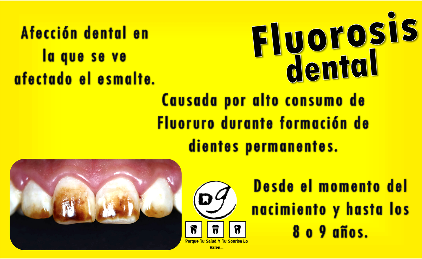 Dental G, Porque Tu Salud y Tu Sonrisa Lo Valen..: ¿Como podemos ayudar ...