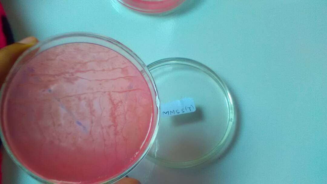LAPORAN PRAKTIKUM UJI SALMONELA PADA SARI BUAH ~ Industrial Chemistry'B ...