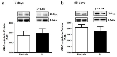 Neuromics: The Role of Obesity in Obstructive Sleep Apnea (OSA)