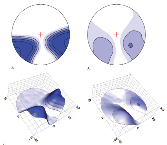 Eye 2 Eye Optometrists: OPTICAL CHARACTERISTICS OF GENERAL PURPOSE ...