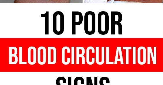 7 Poor Blood Circulation Signs: Are Your Papercuts Taking WAY Too Long ...