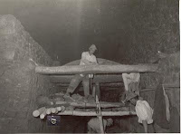 Sin amalgamas: Desintoxicación de mercurio: acrodinia