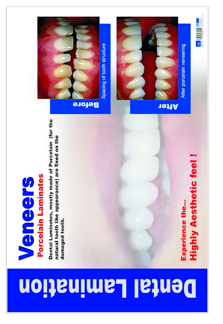 Dental Posters: Dental Posters