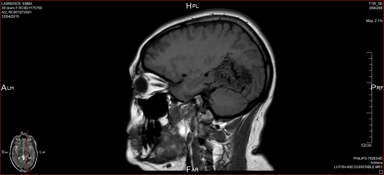 What’s wrong with you now…..spaghetti brain?