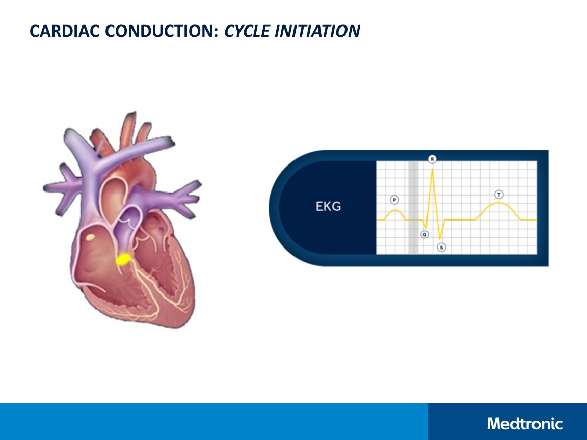CVT Mohd Farid: Heart Rhythm Interpretation Part I-Medtronic Academy