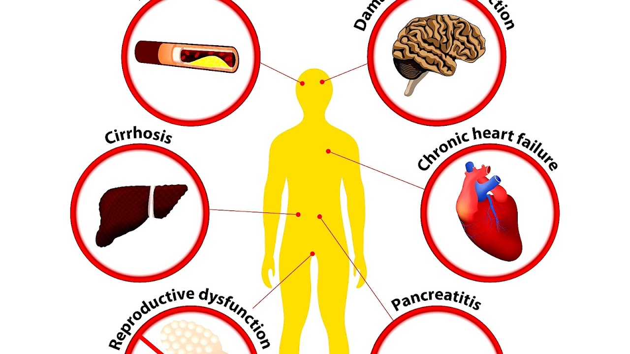 Short term Effects Of Alcohol Consumption Effect Choices short-term-effects-of-alcohol-consumption-effect-choices