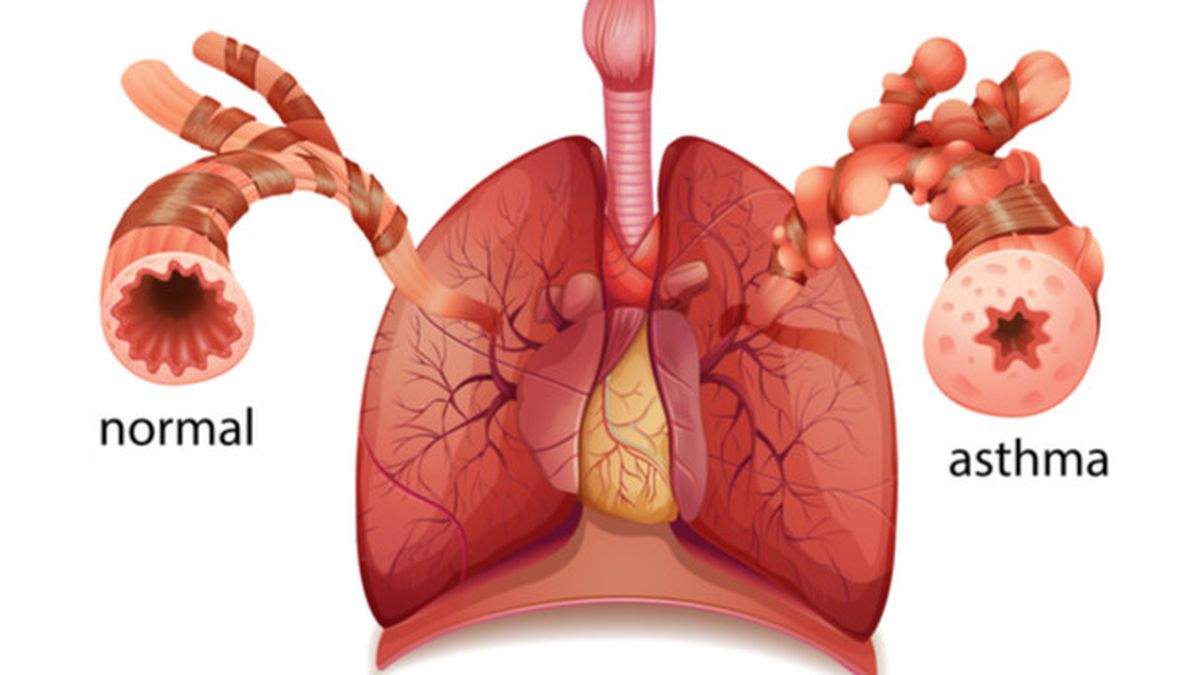 Protein Penyebab Asma Ternyata Bisa Membuat Kemampuan Sel Menurun!