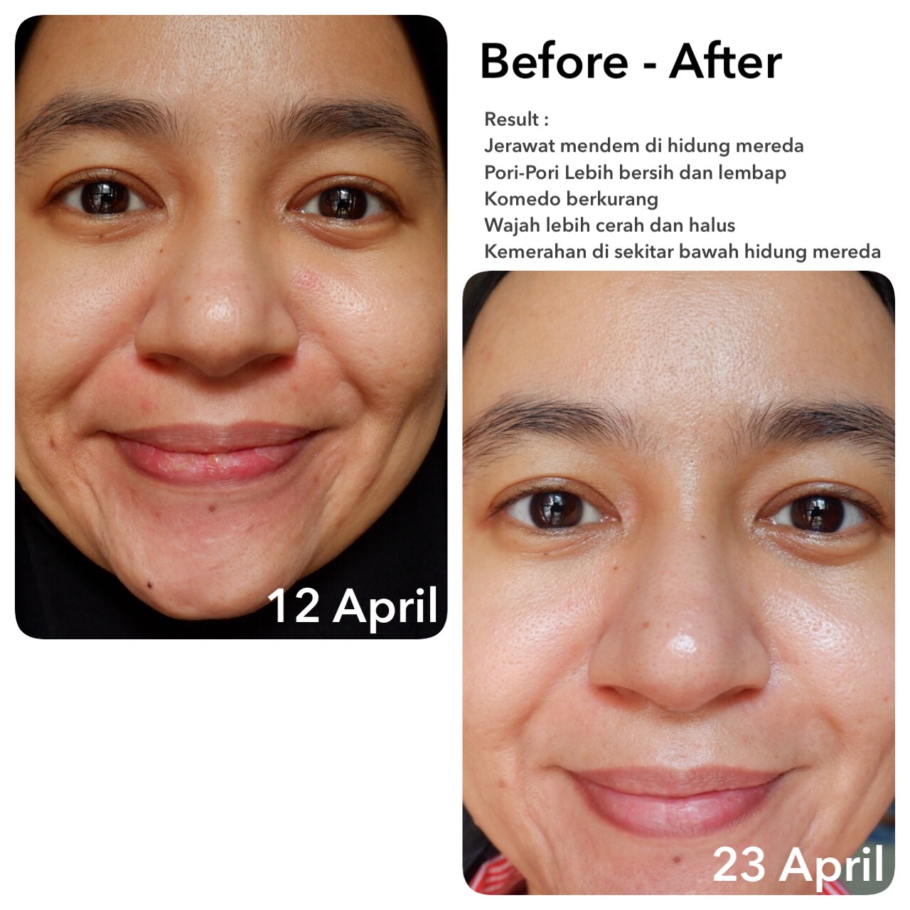 REKOMENDASI MASKER HYDRATING DAN COCOK DI MASA PANDEMI : EILEEN GRACE ...