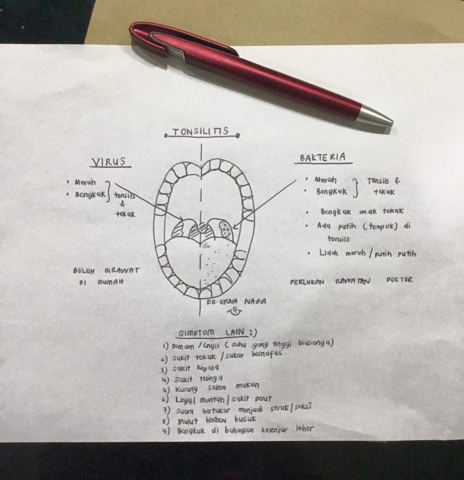 Tonsil Bengkak: Cara Atasinya Bagi Kanak-Kanak