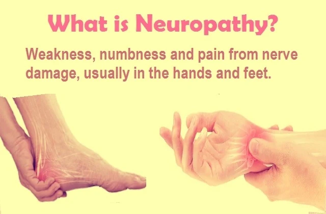 What is Neuropathy? - Types, Symptoms and Causes of Neuropathy
