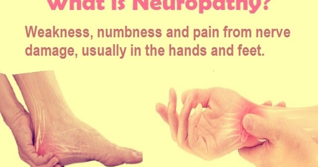 What is Neuropathy? - Types, Symptoms and Causes of Neuropathy - The ...