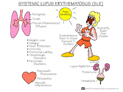 HELLO PEEPS!! :D: APA ITU SLE?
