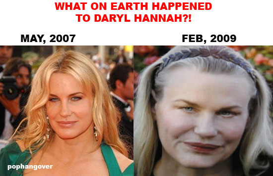 Daryl Hannah ~ 100 plastic surgery