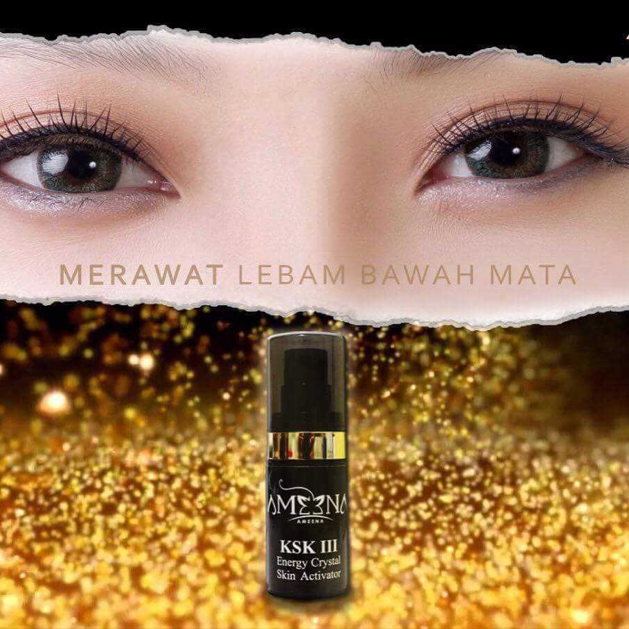 Tips atasi masalah lebam bawah mata | irrayyan.com