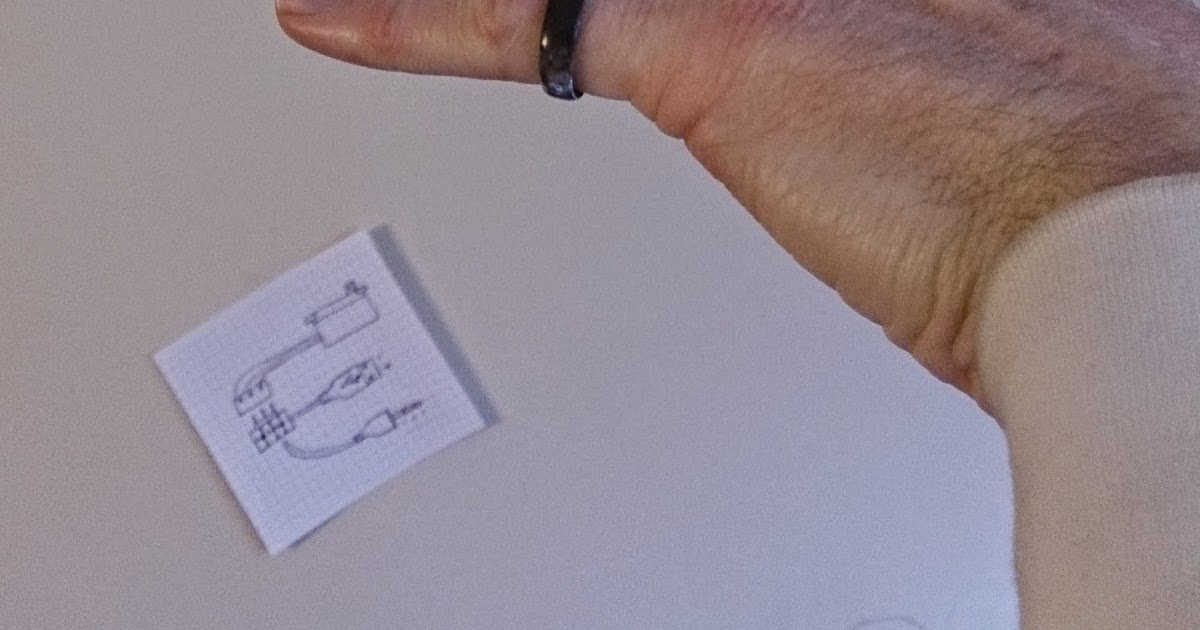 20140413 (Su) Implanted Finger Magnet COMPLETED