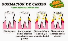CARIES DENTAL EN LOS NIÑOS : CAUSAS DE LA CARIES