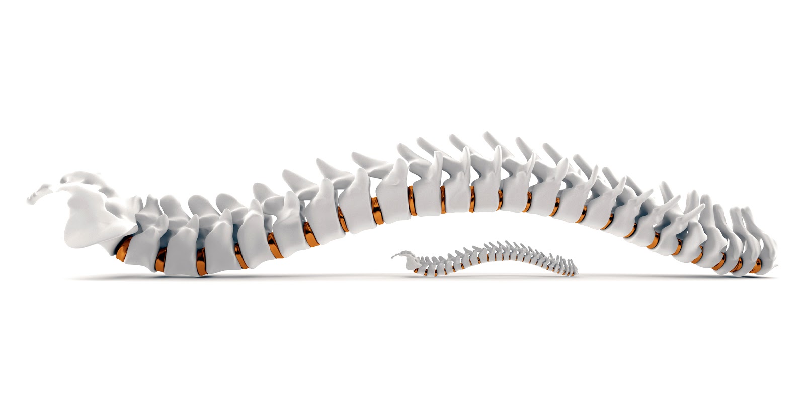 What is the Vertiflex Procedure?